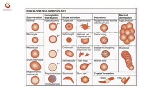 Abnormal morphology of rbc notes | PDF