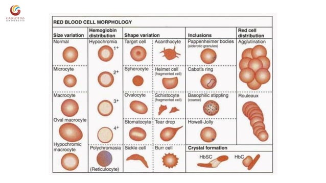 Abnormal morphology of rbc notes | PDF