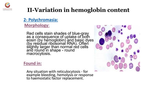 Abnormal morphology of rbc notes | PDF