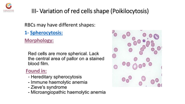 Abnormal morphology of rbc notes | PDF