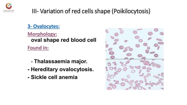 Abnormal morphology of rbc notes | PDF