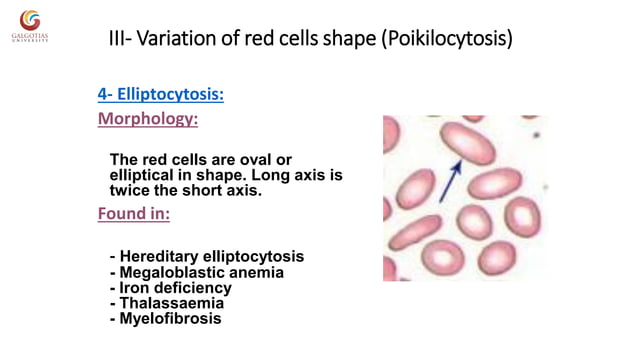 Abnormal morphology of rbc notes | PDF
