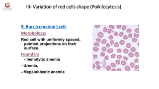 Abnormal morphology of rbc notes | PDF