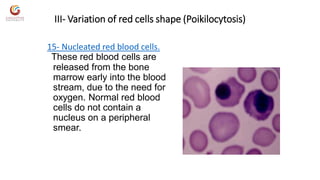 Abnormal morphology of rbc notes | PDF