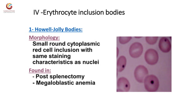 Abnormal morphology of rbc notes | PDF
