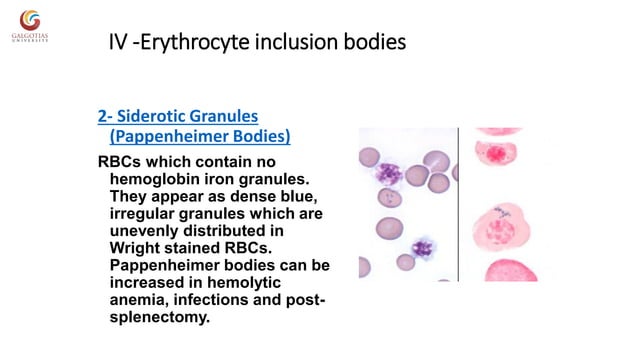 Abnormal morphology of rbc notes | PDF