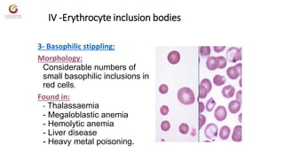 Abnormal morphology of rbc notes | PDF