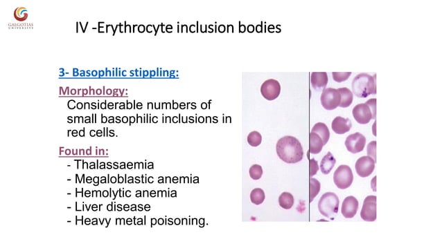 Abnormal morphology of rbc notes | PDF