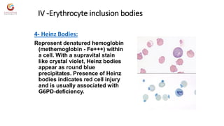 Abnormal morphology of rbc notes | PDF