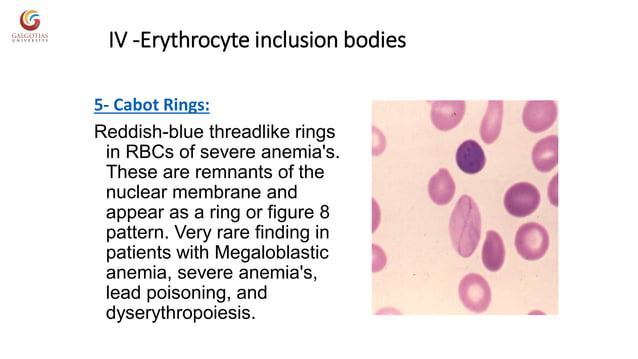 Abnormal morphology of rbc notes | PDF