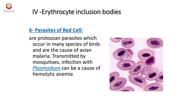 Abnormal morphology of rbc notes | PDF