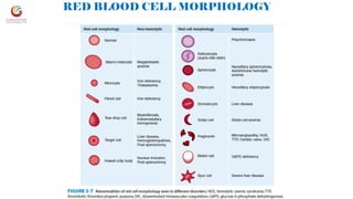 Abnormal morphology of rbc notes | PDF