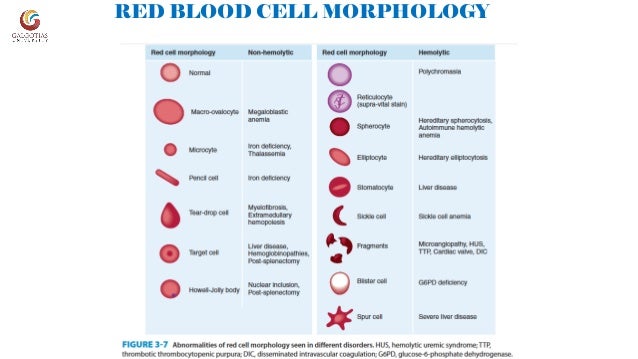 Abnormal morphology of rbc notes