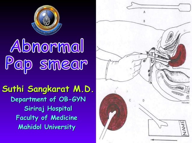 Abnormal pap smear ศิริราช ppt | PPT