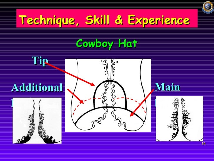 Abnormal pap smear ศิริราช ppt