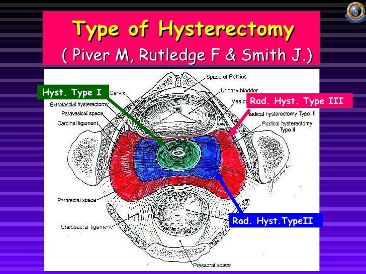 Abnormal pap smear ศิริราช ppt