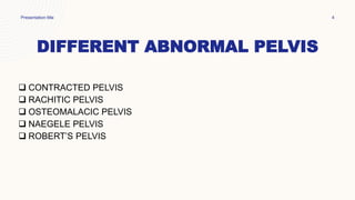 Abnormal pelvis.pptx