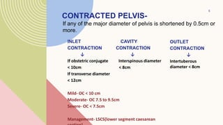 Abnormal pelvis.pptx