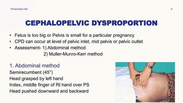 Abnormal pelvis.pptx