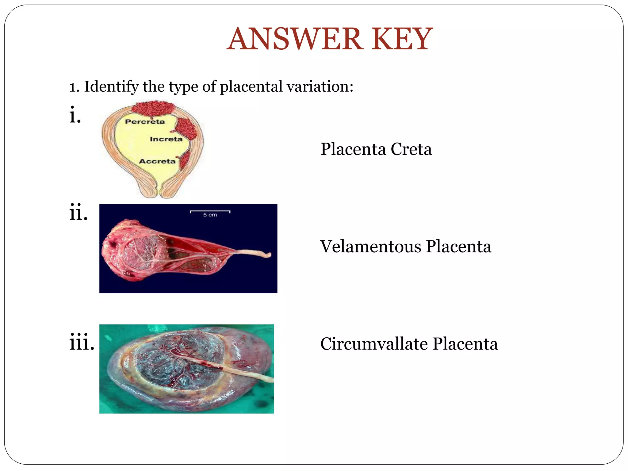 Abnormal placenta | PPTX