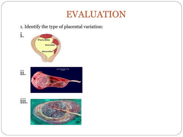 Abnormal placenta | PPTX | Pregnancy | Reproductive Health