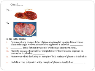 Abnormal placenta | PPTX