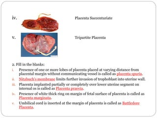 Abnormal placenta | PPTX