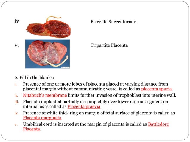 Abnormal placenta | PPTX | Pregnancy | Reproductive Health