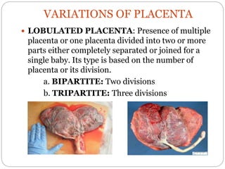 Abnormal placenta | PPTX