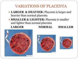 Abnormal placenta | PPT