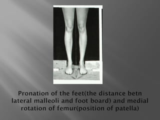 Abnormal posture in human body biomechanics.pdf