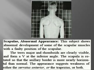 Abnormal posture in human body biomechanics.pdf