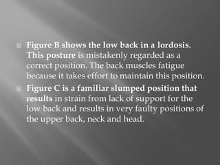 Abnormal posture in human body biomechanics.pdf