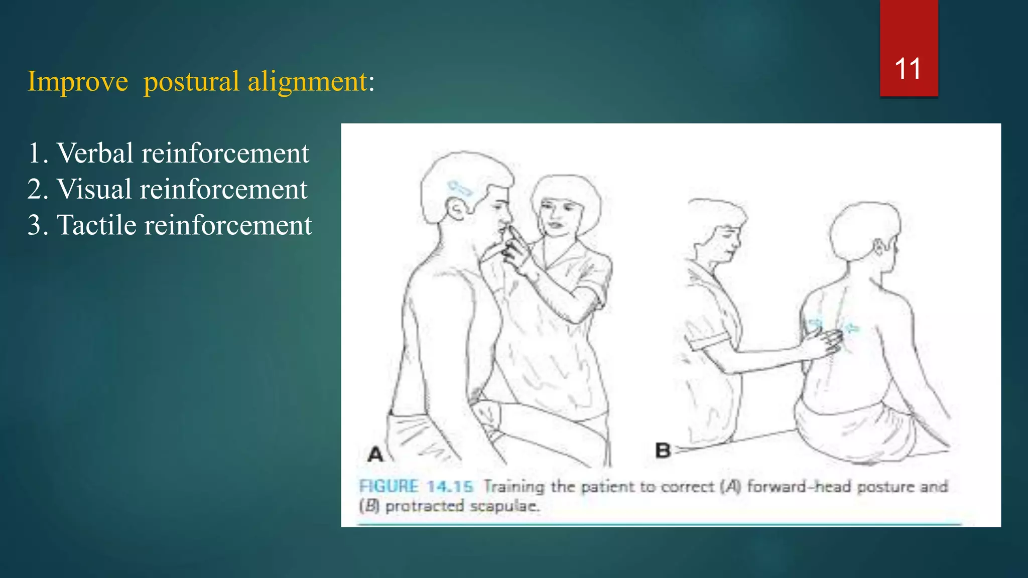 Abnormal posture in rs | PPTX