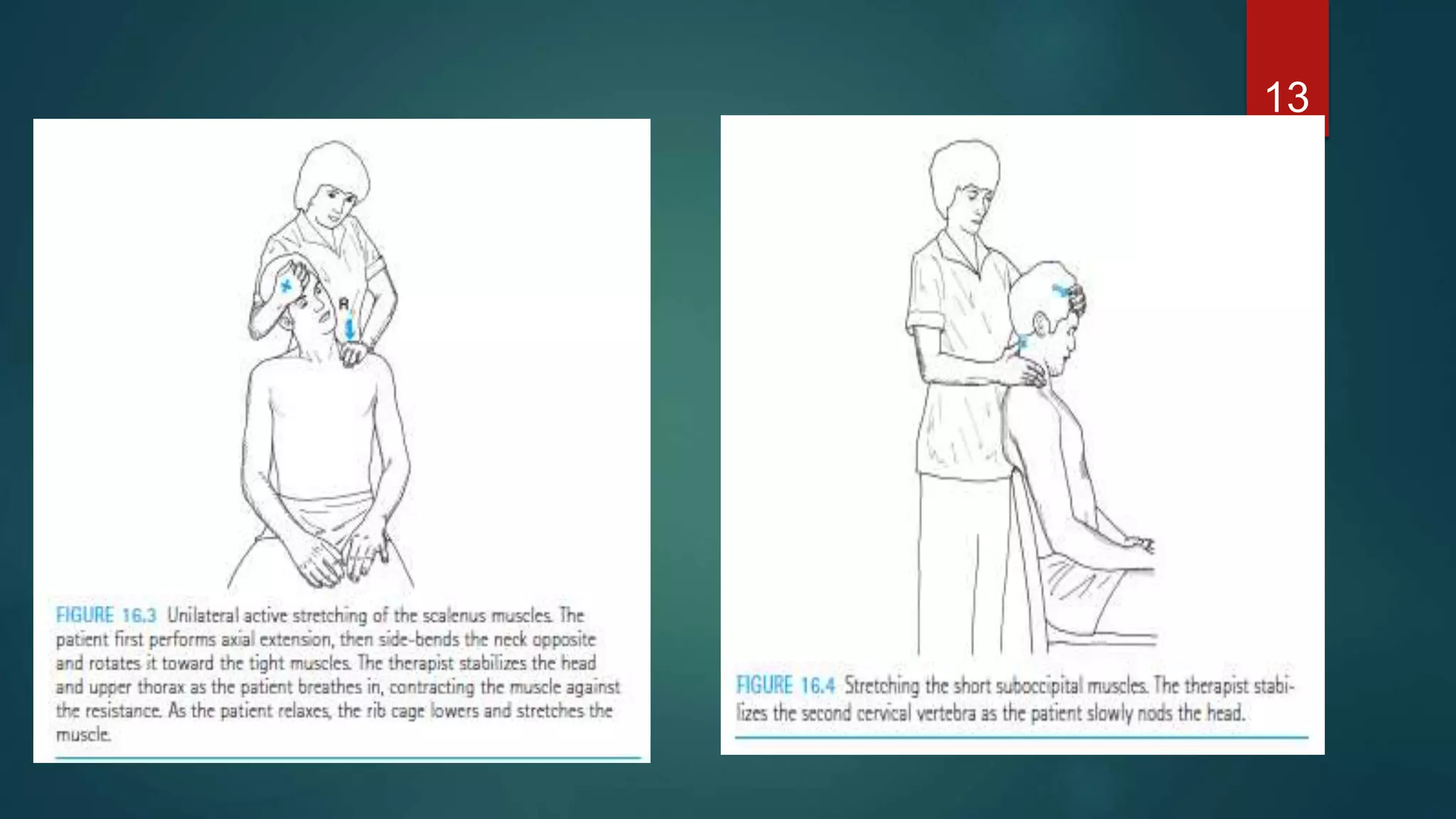 Abnormal posture in rs | PPTX