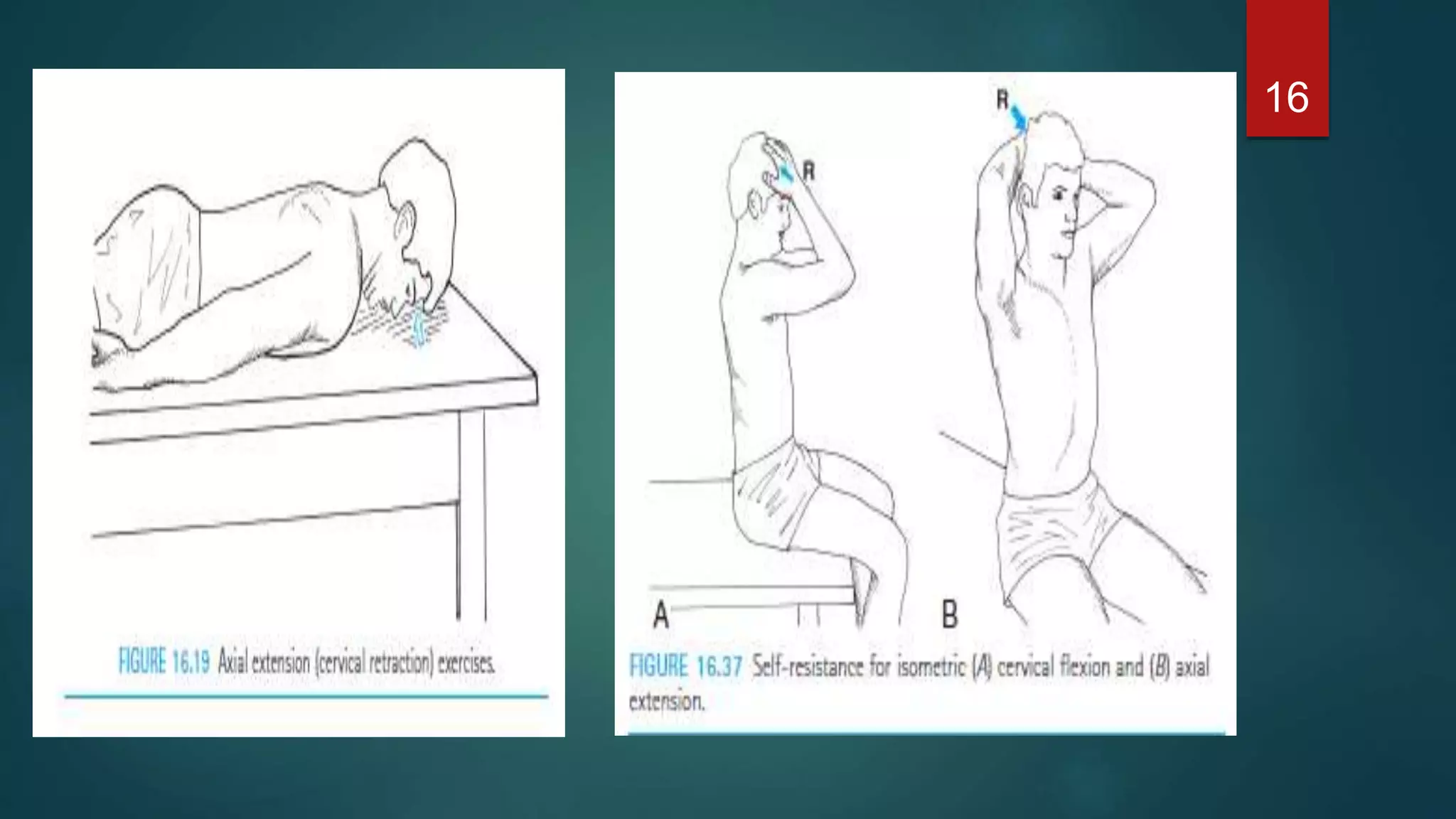 Abnormal posture in rs | PPTX