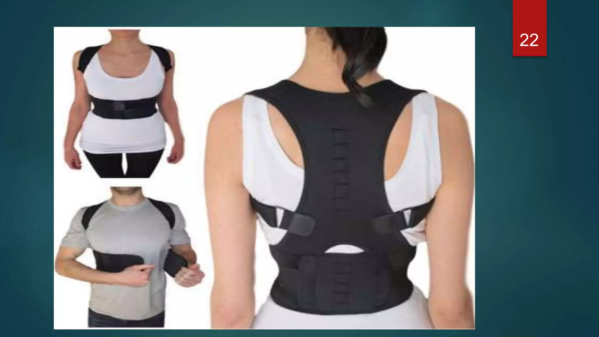 Abnormal posture in rs | PPTX