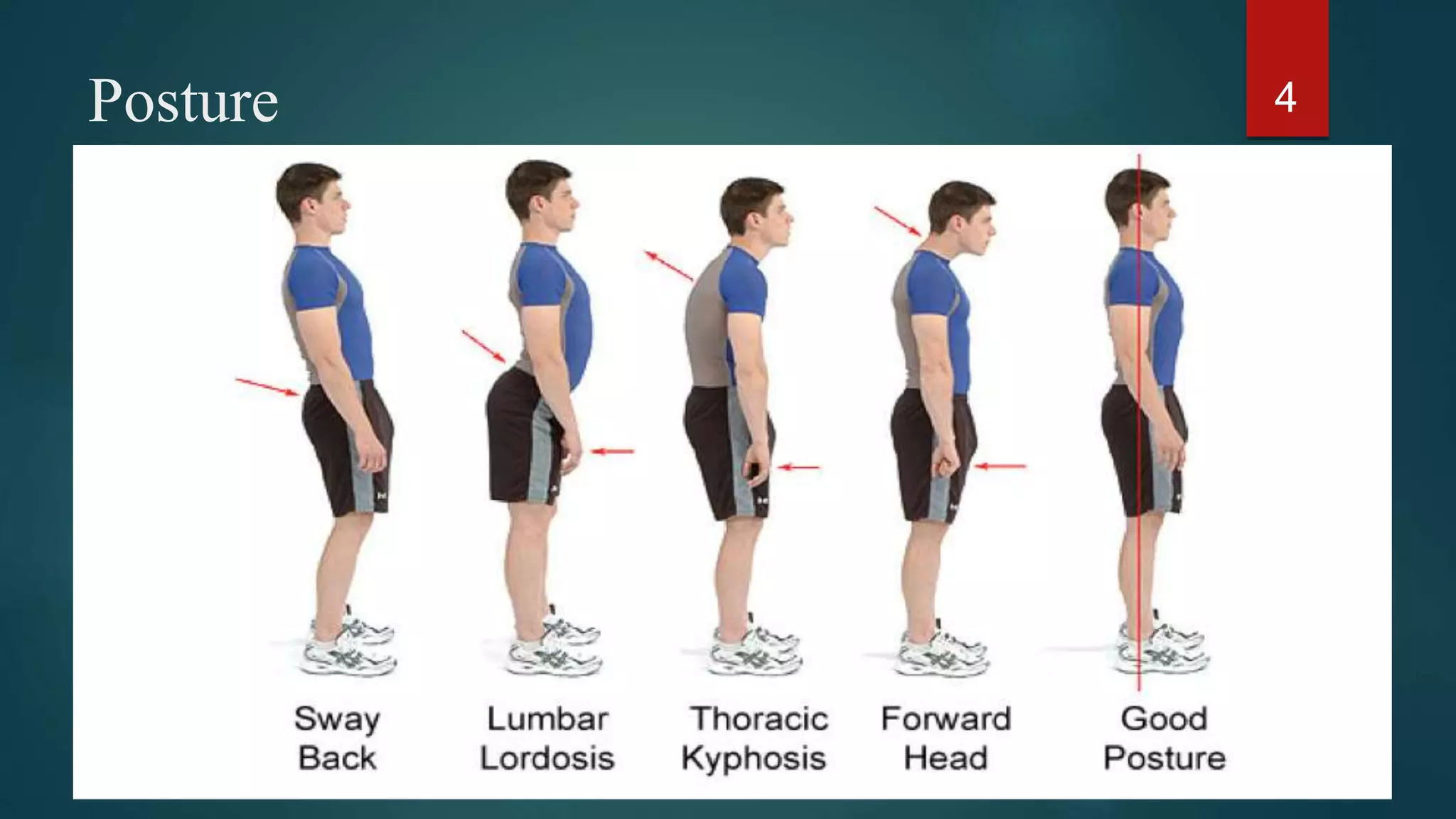 Abnormal posture in rs | PPTX