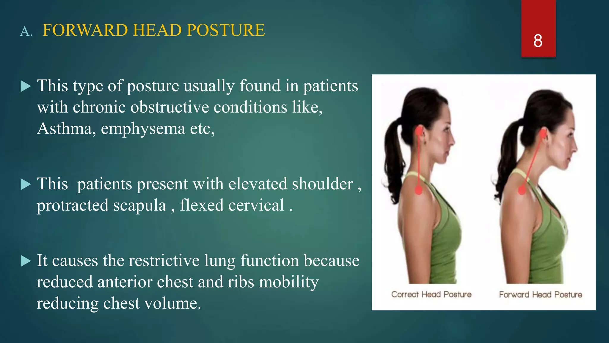 Abnormal posture in rs | PPTX | Lung and Respiratory Health | Diseases ...