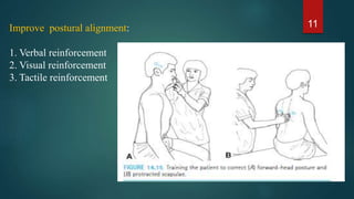 Abnormal posture in rs | PPTX