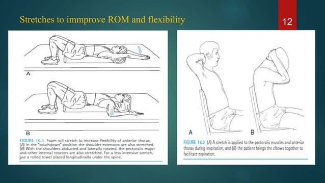 Abnormal posture in rs | PPTX | Lung and Respiratory Health | Diseases ...