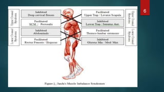 Abnormal posture in rs | PPTX