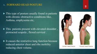 Abnormal posture in rs | PPTX