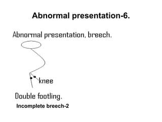 Abnormal presentation.m2ppt | PPT
