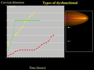 ABNORMAL PROGRESS.ppt