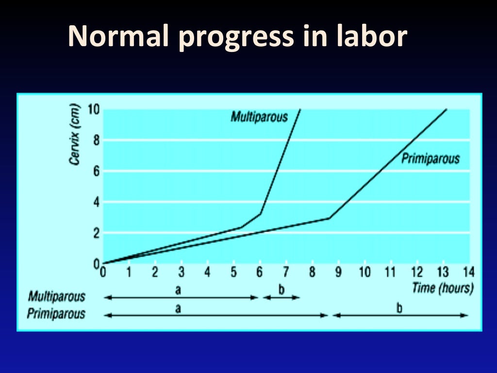 Abnormal progress of labor for 4th year med.students