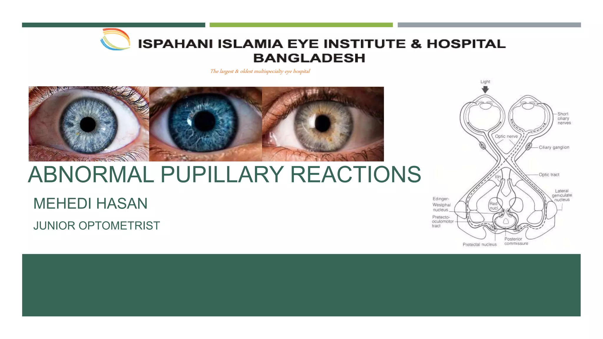 Abnormal pupil reactions - mehedi hasan | PPTX