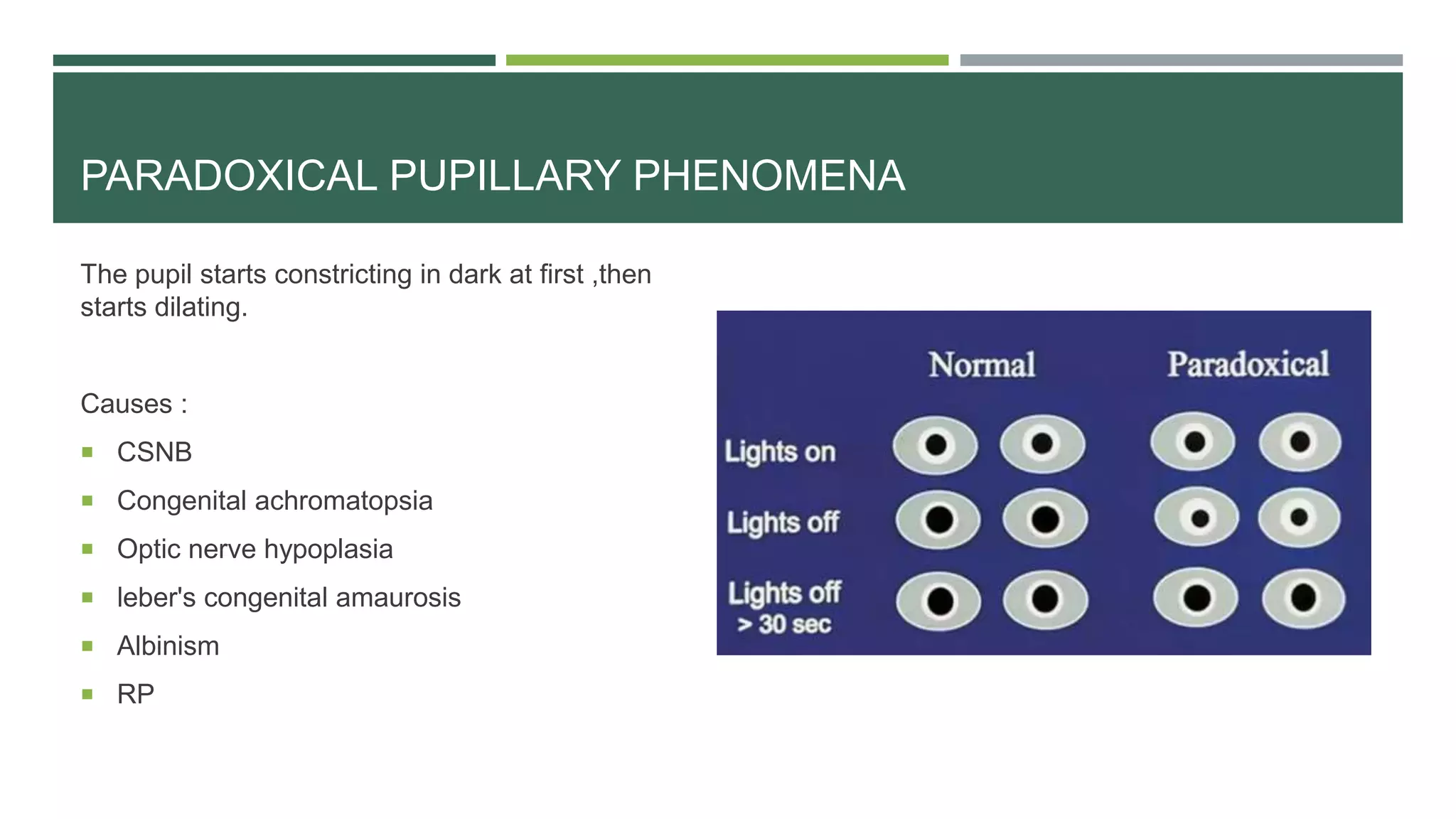 Abnormal pupil reactions - mehedi hasan | PPTX