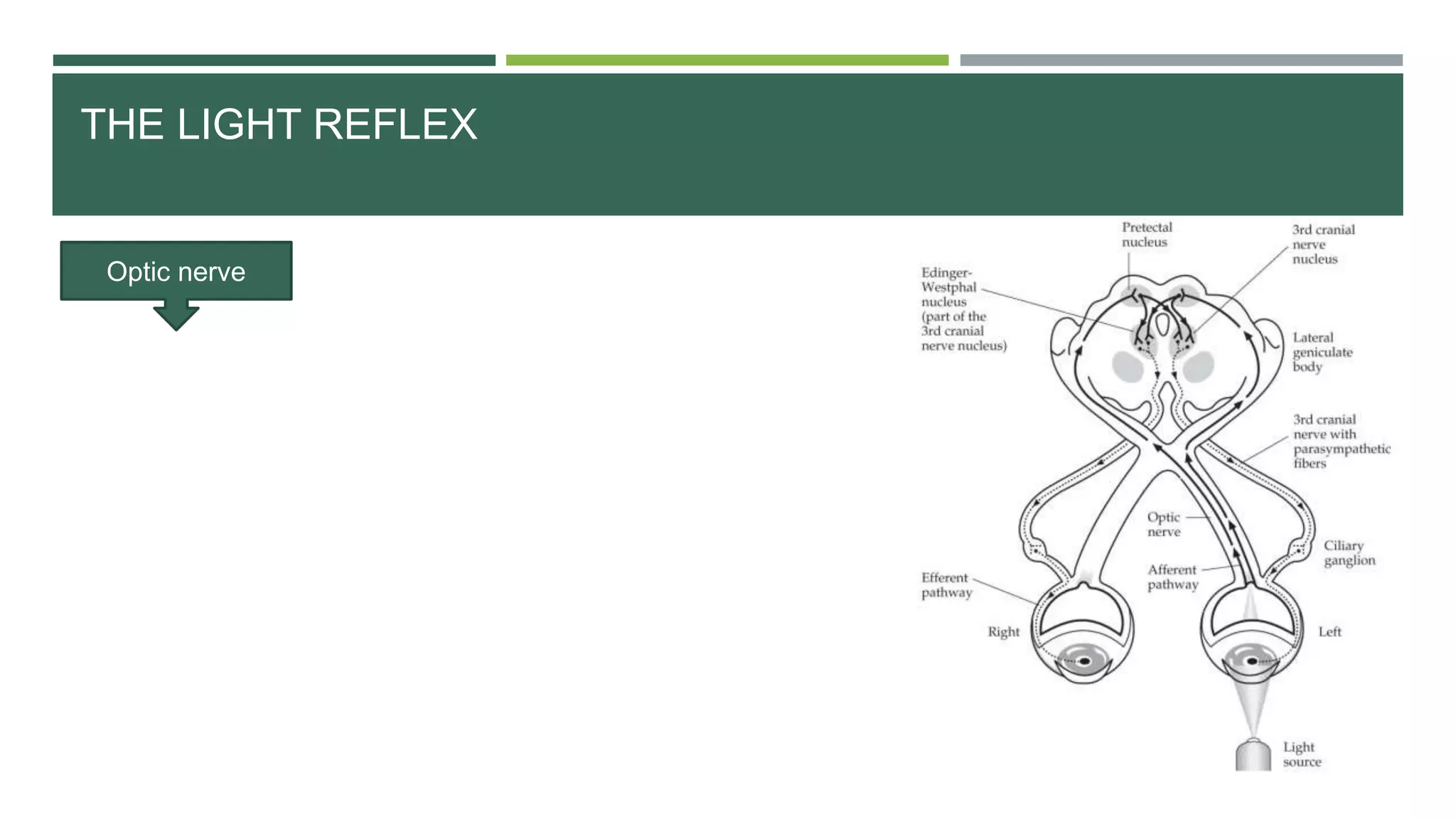 Abnormal pupil reactions - mehedi hasan | PPTX