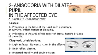 Abnormal reactions of pupil | PPTX